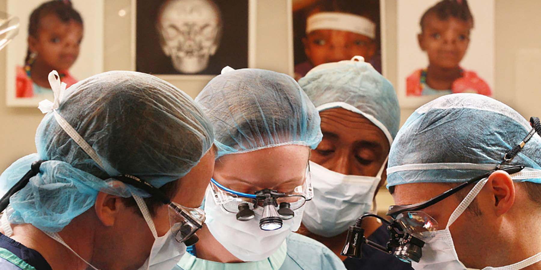 Cleft Lip and Palate – Division of Plastic, Reconstructive & Aesthetic ...